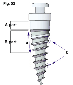 오솔루션 Selection of the orthodontic mini-implant and determination of ...